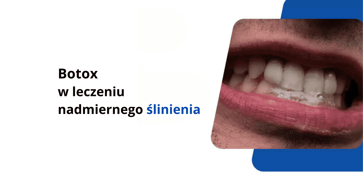 Toksyna botulinowa w leczeniu ślinotoku | Centrum Medyczne Magwise