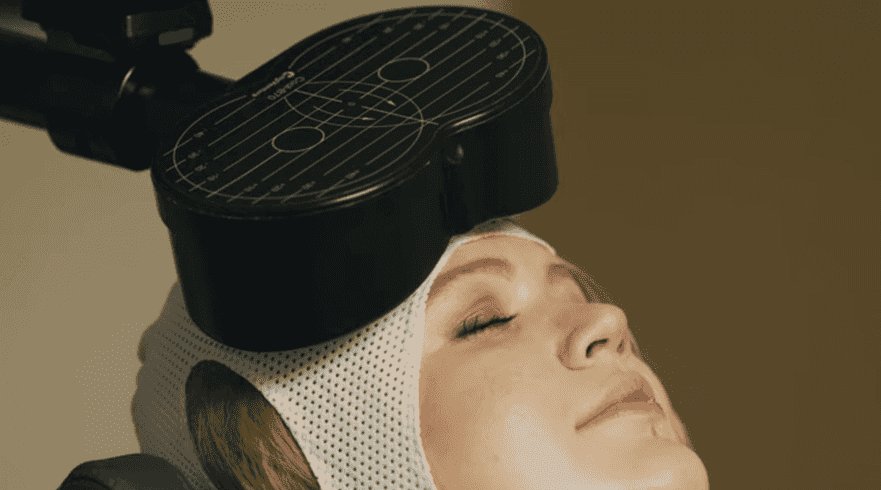 Terapia TMS: przezczaszkowa stymulacja magnetyczna | Centrum Medyczne ...